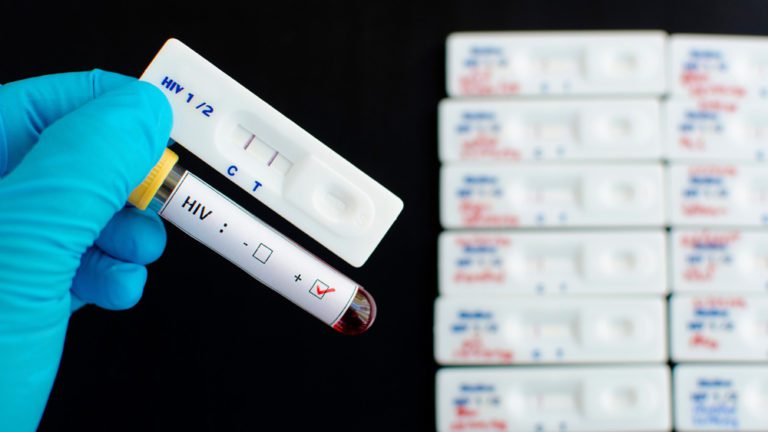 How Accurate are Rapid Tests for HIV? - Rapid Test & Trace Canada