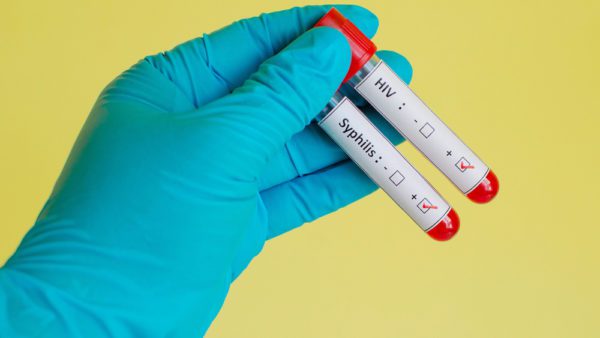 How Long Does STI Test Results Take? - Rapid Test & Trace Canada