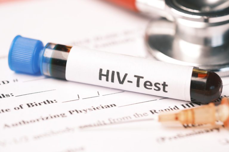 How to Test for HIV using an At-Home Test Kit? - Rapid Test & Trace Canada