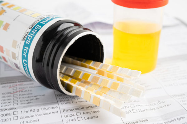 How Do You Interpret Results from UTI Test Strips?